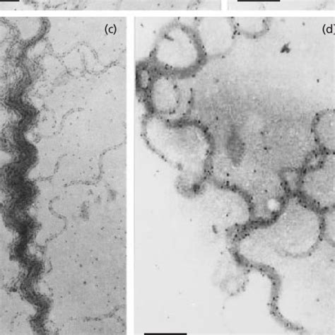 Electron Micrographs Showing Flagellated C Difficile Strains Kohn A
