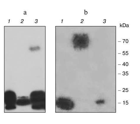 Dna Binding Protein Blot Assay With Electrophoretically Fractionated