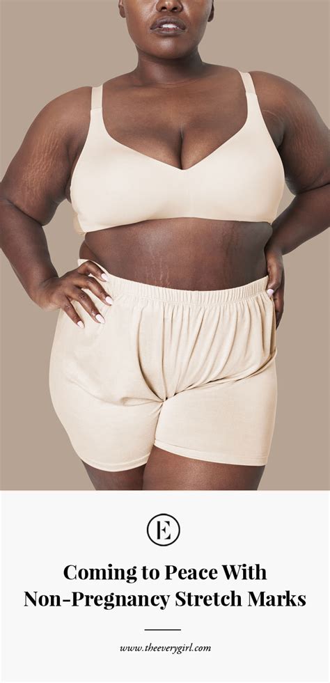 Coming To Peace With My Non Pregnancy Stretch Marks The Everygirl