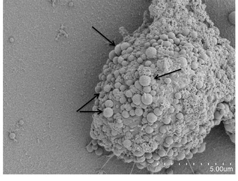 sem image of a cell particle hybrid developed by our group as a