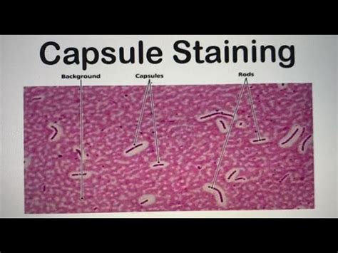Capsule Stain Differential Staining Techniques Microbiology A