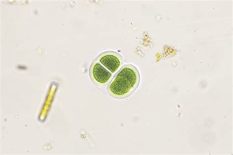 Croococcus The Microscopic Life Of Shetland Lochs