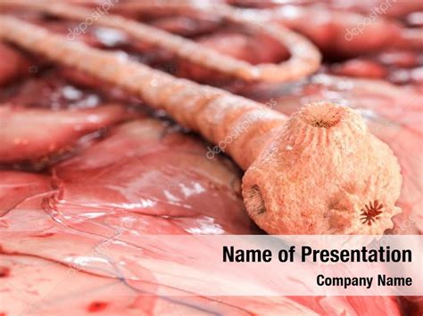 Detaild Pork Tapeworm Taenia Solium Powerpoint Template Detaild Pork
