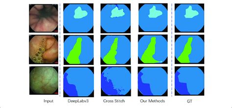 Visualization Of The Segmentation Result In Our Proposed