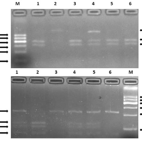 the restriction fragment length polymorphism analysis to determine the