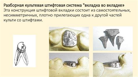 Штифтовые зубы — презентация