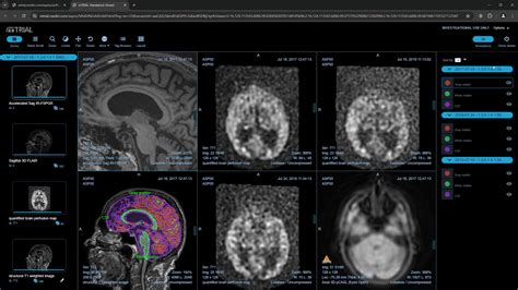 Web Based Interactive Dicom Viewer