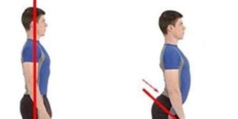 욱신욱신 허리 통증 심하다면 골반전방경사 확인해 보자 3분건강레터