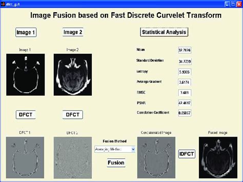 C Result Of Image 1 And Image 2 Fused By Proposed Method With Download Scientific Diagram