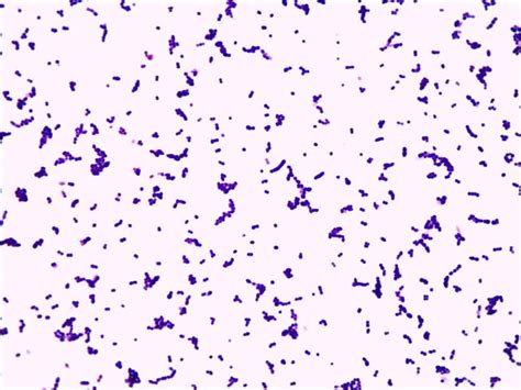 Streptococcus Pyogenes Fundación Io