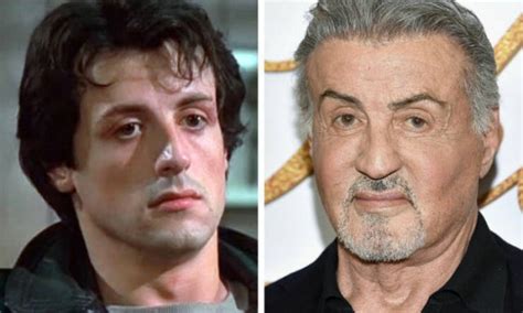 Celebrities Before And After Plastic Surgery Celebrities