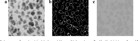 Figure 2 From Modified Local Entropy Based Transition Region Extraction