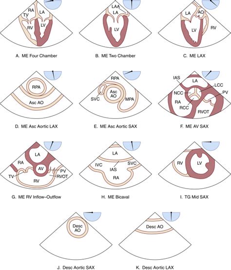 Focused Transesophageal Echocardiography Clinical Tree
