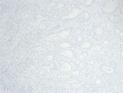 Surgical Specimen Splenectomy Immunohistochemistry Images The Download Scientific Diagram