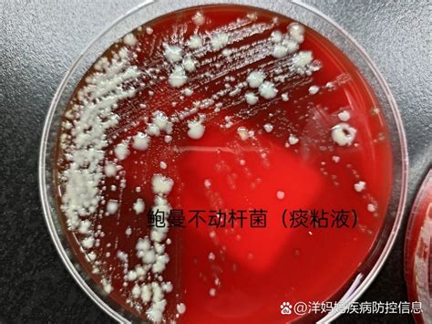 鲍曼不动杆菌（aba）