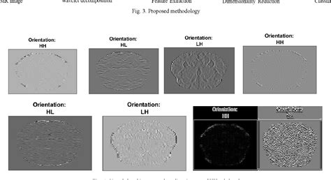 Figure 1 From Wavelet Based Alzheimers Disease Detection Using Edge