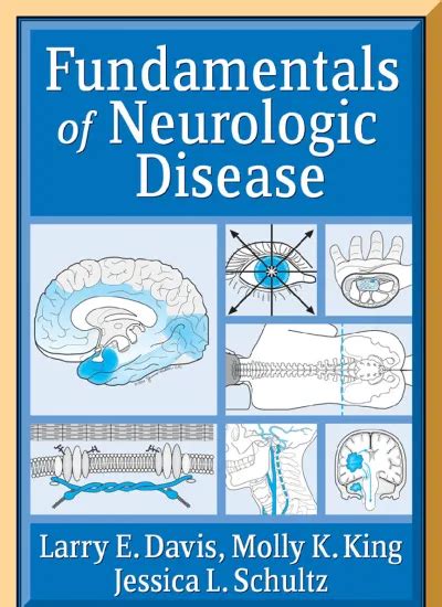 Diabetic Distal Symmetrical Polyneuropathy
