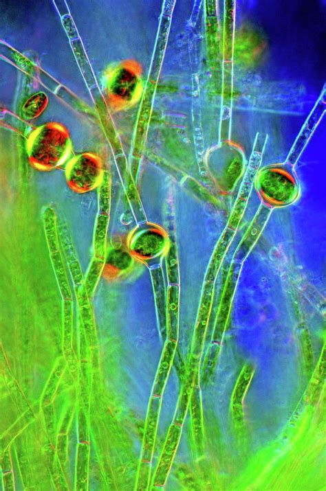 Oedogonium Green Algae Photograph By Science Photo Library Pixels