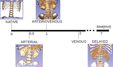 Figure 1 From Tubular Structures Segmentation Of Pediatric Abdominal