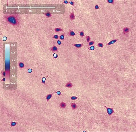 Quantitative Phase Imaging Advances Regenerative Medicine Features