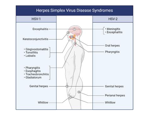 Disease Syndromes Of Herpes Simplex Virus Biorender Science Templates