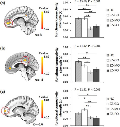 Group Comparisons Of Default Mode Network Connectivity Using Analysis