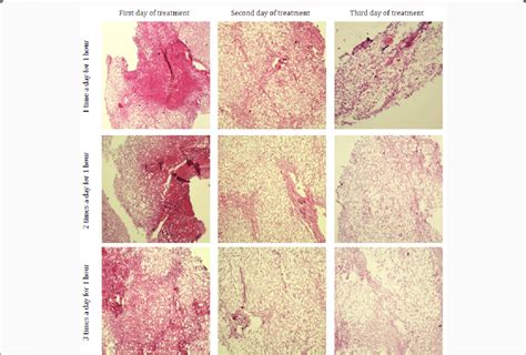 The Effectiveness Of Hlf Decellularization Depending On The Choice Of A