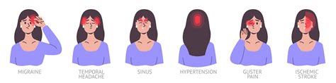 Ilustración De Tipos De Dolor De Cabeza Retrato De Mujer Con Diferentes