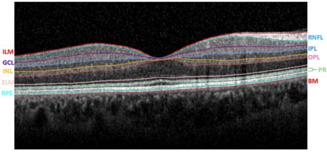 layers of the retina