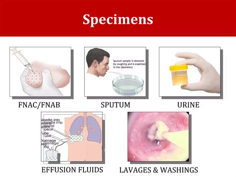 Cell Block In Cytology Ppt