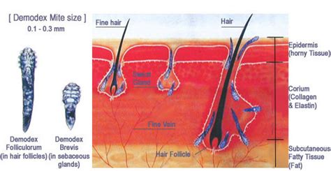 Demodex Mites Symptoms