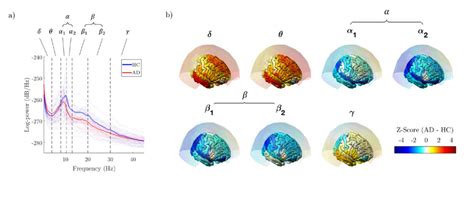 Cerebral Imaging Meg Overview