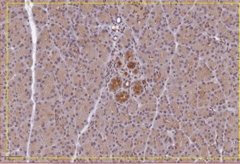 Quantification Cytoplasmic Ihc With High Background Image Analysis