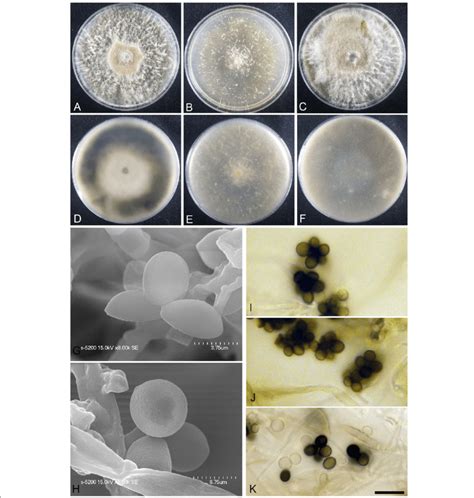 Arthrinium Pusillispermum Kuc21321 A C Colonies On Pda A Mea