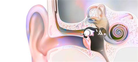 Cochlear Implant Vietnam Veteran Receives Life Altering Cochlear