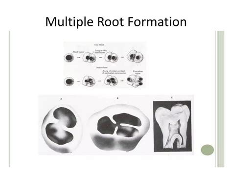 Formation Of Permenant Tooth Root And Supporting Tissues Pptx