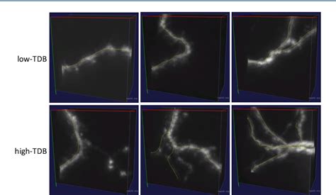Figure 1 From Classifying The Tracing Di Culty Of 3d Neuron Image Blocks Based On Deep Learning