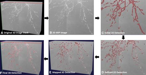 The Workflow Of 3d Neurite Signal Detection A An Example Of The