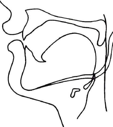 Section Of Labial Velar Approximant W Download Scientific Diagram