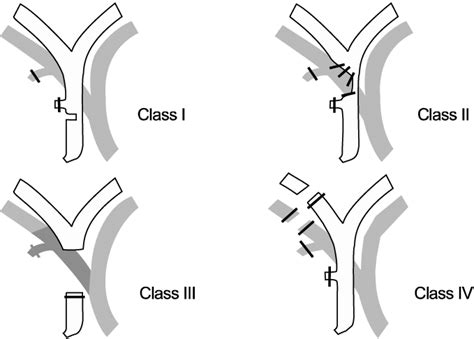 Stewart Way Classification 15 Download Scientific Diagram