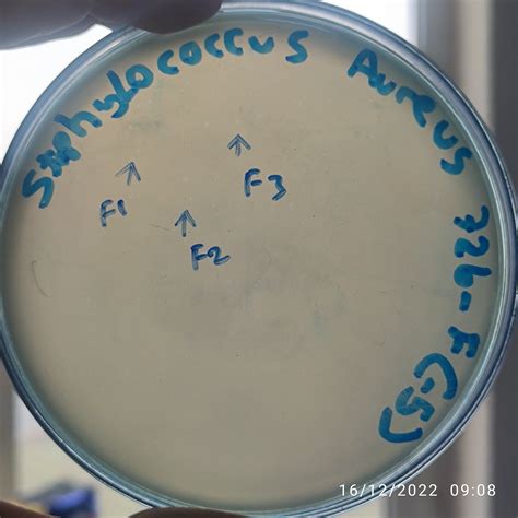 Staphylococcus Aureus Bacteriophage 152726f Mikroliz