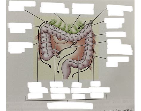 Dms 109 Paracolic Gutters Extra Credit Quiz