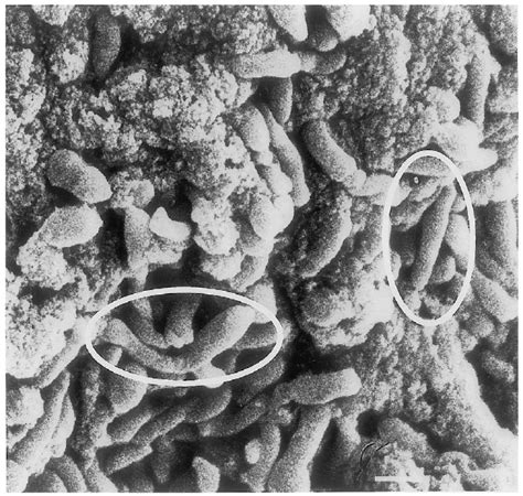 Scanning Electron Micrograph Of The Isolate Circle Shows A Budding