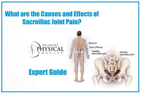 Sacroiliac Joint Dislocation Treatment At Mark Fletcher Blog