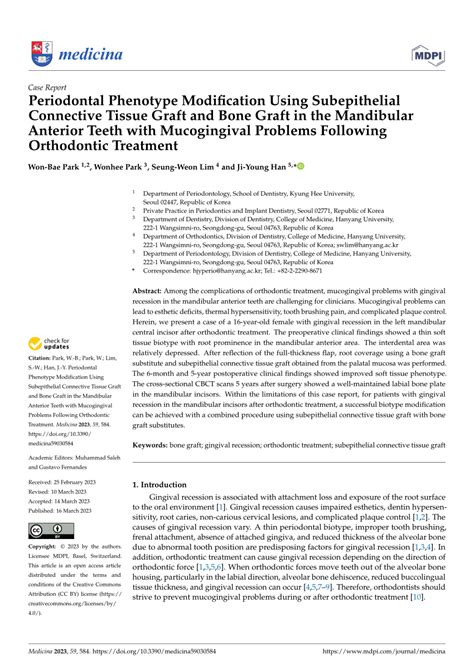 Pdf Periodontal Phenotype Modification Using Subepithelial Connective