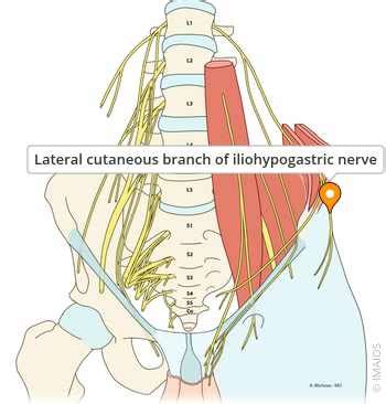 Iliohypogastric Nerve