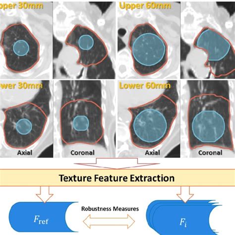 A Flow Chart For The Robustness Analysis Of Normal Lung Ct Texture