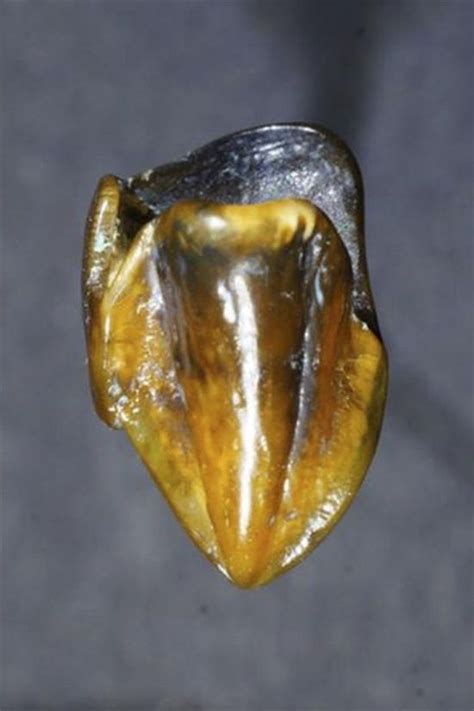 Dentaltown Archaeology Fossil Teeth Discovery In Germany Could Re