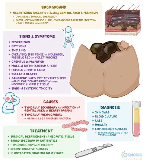 Fournier Gangrene What Is It Causes Signs And Symptoms And More