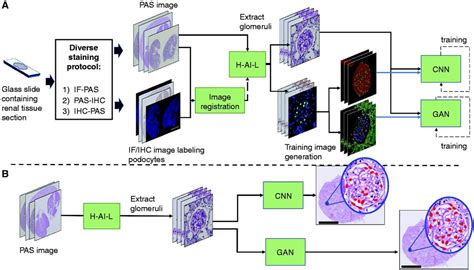 podosighter a cloud based tool for label free podocyte dete